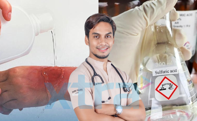 [VIDEO] Doktor Ini Kongsi Bantuan Awal Jika Terkena Asid | XTRA